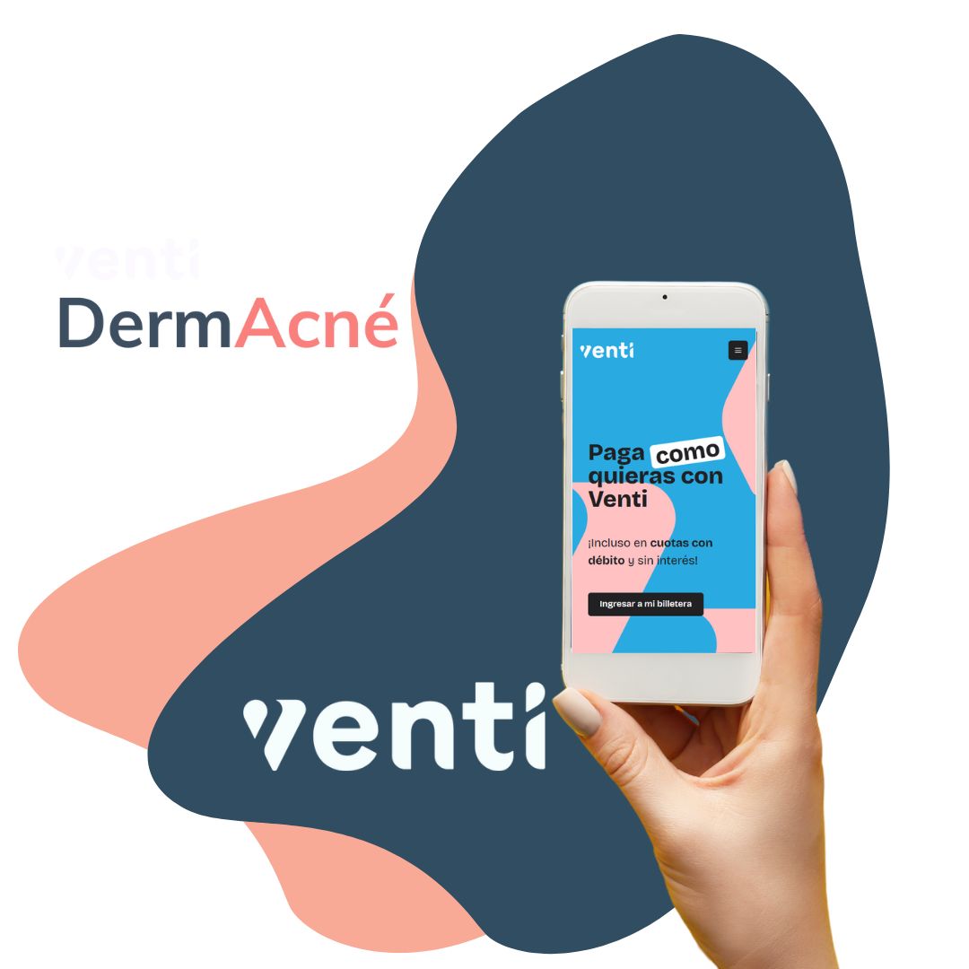 Ahora aceptamos Venti Pay – DermAcné